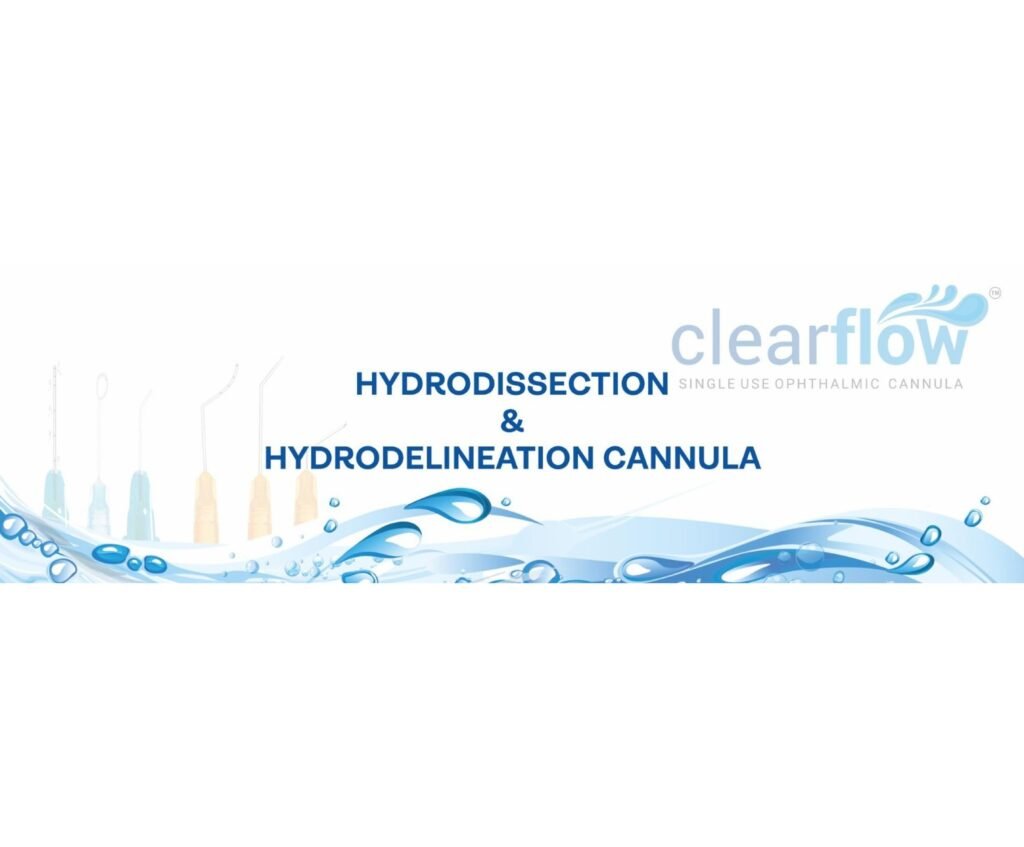 Hydrodissection/Hydrodelineation Cannula | Ophthalmic Surgery ...